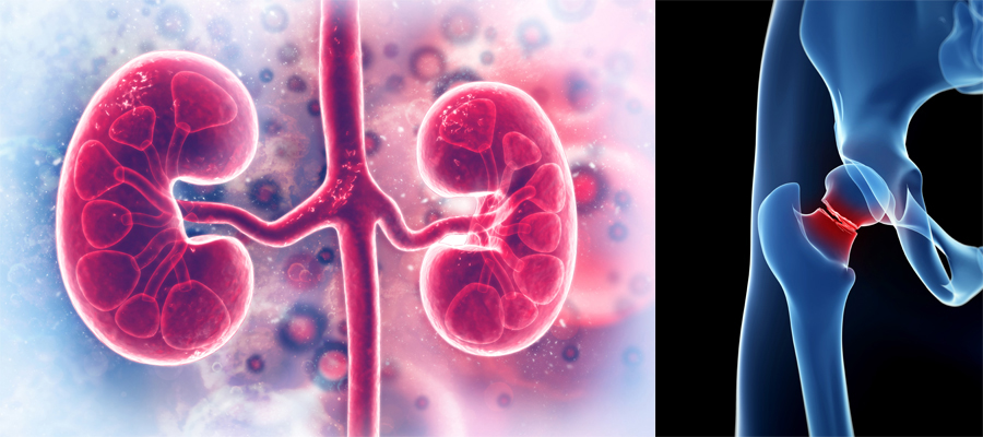 Diagnostic accuracy study of a MALDI-MS biomarker of acute kidney ...